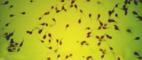 Esterilidade e Infertilidade | inviTRA - inviTRA